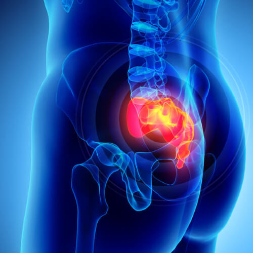 Lower Back Pain ESP Physio Scotland Lower Back Pain ESP Physio Scotland