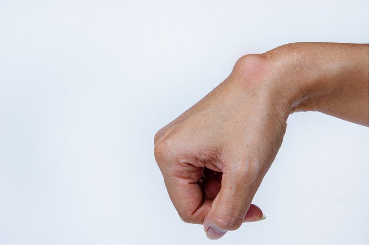 Common Wrist Injuries - ESP Physio